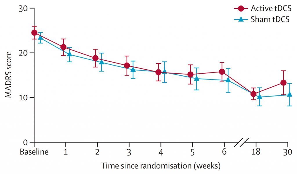 tDCS as a treatment for depression - Advanced Interventions Service